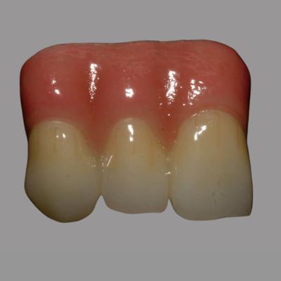 China CAD / CAM Dental Layered Zirconia Bridge With Pink Porcelain for sale