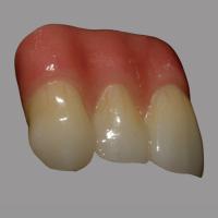 China Digital Design Dental Lab | CAD / CAM Dental Layered Zirconia Bridge With Pink Porcelain for sale