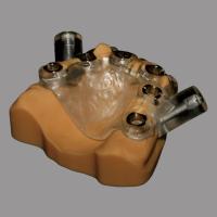 China Digital Dental Solutions Lab | Custom Transparent Dental Implant Solutions Surgical Stent Ergonomic Design for sale