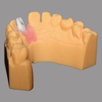 China ADL Dental Lab | White Custom Zirconia Abutment Natural Looking For Dental Restoration for sale