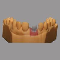 China White Custom Zirconia Abutment Natural Looking For Dental Restoration for sale