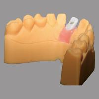 China ADL Dental Lab | White Custom Zirconia Abutment Natural Looking For Dental Restoration for sale