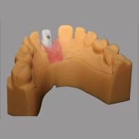 China ADL Dental Lab | White Custom Zirconia Abutment Natural Looking For Dental Restoration for sale