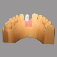 China ADL Dental Lab | White Custom Zirconia Abutment Natural Looking For Dental Restoration for sale
