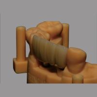 China China Dental Outsourcing | Gold Plating Nitrogen Titanium Abutments Dental Implants Cad/Cam Compatibility for sale
