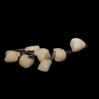 China Implant Dental Lab | Silver Custom Titanium Abutments Dental Implants With Full Zirconia Crown for sale