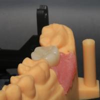 China Implant Dental Lab | Silver Custom Titanium Abutments Dental Implants With Full Zirconia Crown for sale