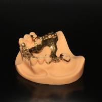 China Anodized 3D Printed Titanium Framework Lightweight For Sensitive Skin for sale