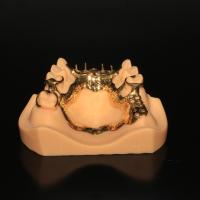 China Anodized 3D Printed Titanium Framework Lightweight For Sensitive Skin for sale