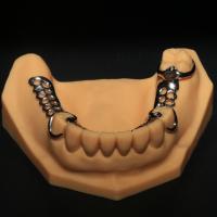 China China Dental Lab Outsourcing  | High Strength 3D Printed Argen Dental Framework With Clear Clasps for sale