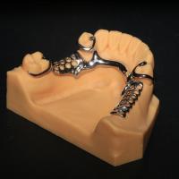 China High Strength 3D Printed Argen Dental Framework With Clear Clasps for sale