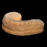 China Digital Dental Lab | Clear Soft Night Guard Occlusal Splint Breathability Heavy Duty Protection for sale