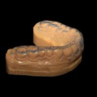 China Digital Dental Lab | Clear Soft Night Guard Occlusal Splint Breathability Heavy Duty Protection for sale