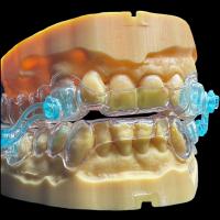 China Dental Lab Outsourcing | Anti Snoring Device Dental Occlusal Splint Clear Color Non Invasive for sale