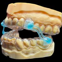 China Dental Lab Outsourcing | Anti Snoring Device Dental Occlusal Splint Clear Color Non Invasive for sale