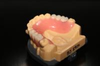 China How Much Does A Flexible Denture Cost | Heat Curing Acrylic Dentures Lucitone 199 Impact Resistant for sale