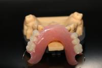 China How Much Does A Flexible Denture Cost | Heat Curing Acrylic Dentures Lucitone 199 Impact Resistant for sale