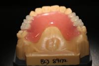 China How Much Does A Flexible Denture Cost | Heat Curing Acrylic Dentures Lucitone 199 Impact Resistant for sale