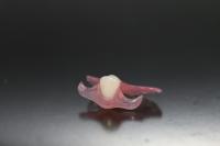 China Flexible Partial Denture Lab | Natural Look TCS Flexible Denture Stain Resistant BPA Free for sale