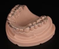 China Digital Dental Solutions Lab | Dental Hard Occlusal Splint 1-3mm For Jaw Pain Relief Protection Oral for sale