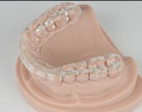 China Digital Dental Solutions Lab | Dental Hard Occlusal Splint 1-3mm For Jaw Pain Relief Protection Oral for sale