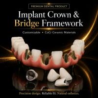 China Custom Implant Crown & Bridge Framework | Dental Lab Outsourcing for sale