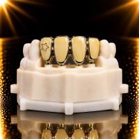 China Digital full metal crown CAD CAM - Custom Gold Open-Faced Crown for sale