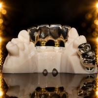 China Digital full metal crown CAD CAM - Custom Gold Open-Faced Crown for sale