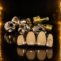 China Digital full metal crown CAD CAM - Custom Gold Open-Faced Crown for sale
