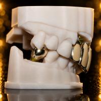 China Digital full metal crown CAD CAM - Custom Gold Open-Faced Crown for sale