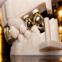 China Digital full metal crown CAD CAM - Custom Gold Open-Faced Crown for sale