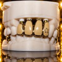 China Digital full metal crown CAD CAM - Custom Gold Open-Faced Crown for sale