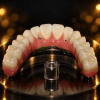 China Dental lab Restoration—AOX  CLASS 2 （Monolithic Zirconia with Pink Staining） for sale