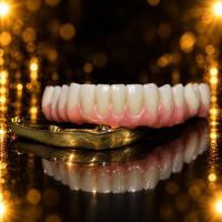 China Custom Dental Prosthesis— AOX CLASS 2（zirconia implant bridge gingival stain ） for sale