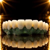 China CE & ISO certified dental prosthesis—Natural‑Esthetic Full Zirconia Bridge for sale