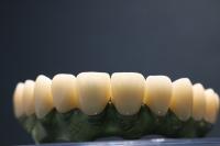China CE & ISO certified dental prosthesis—Natural‑Esthetic Full Zirconia Bridge for sale