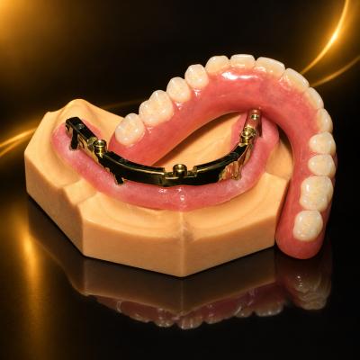 China Lmplant Dental Laboratory | Full Acrylic Denture All On X Dental Lmplants AOX Class 4 With Locator Attachment for sale