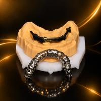China Gigital Dental Laboratory | Class 5 All On 4 AOX Implants With Hybrid Titanium Bar / Clips / Metal Mesh / Full Denture for sale