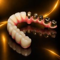 China Dental Implant Lab | Class 2 Hybrid Malong Full Arch AOX Implant Bridge Titanium Bar With Full Solid Zirconia for sale