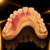 China Digital Denture Lab | Natural Looking Valplast Flexible Partial Adjustable Fracture Resistant for sale