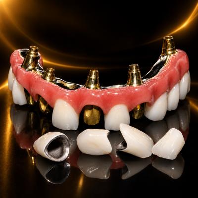 China Digital Dental Solutions Lab | AOX Class I All On 4 Dental Implants Hybrid Titanium Screw Retained PFM for sale