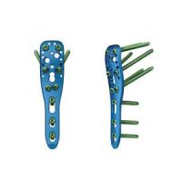 China Orthopedic Small Fragment  Trauma Locking Plate Screw for sale