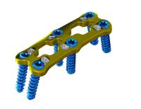China Titanium Vertebra Spinal Anterior Cervical Fixation For Surgery for sale