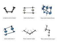 China Orthopedics CE Titanium Ortho External Fixator For Adults for sale