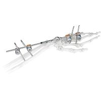 China Medical Orthopedic Surgical Implant Joint Wrist External Fixator for sale