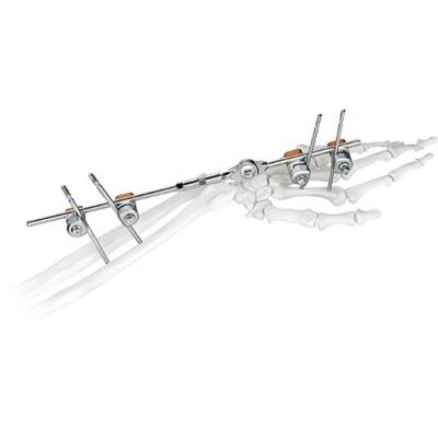 China Medical Orthopedic Surgical Implant Joint Wrist External Fixator for sale