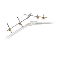 China Orthopedic Surgical Implant Medical Elbow External Fixator Device for sale