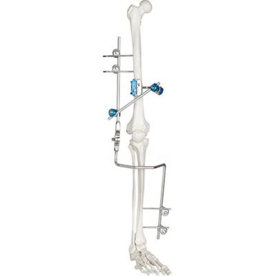 China Medical Knee Joint External Fixation Device Orthopedic Surgical Instruments for sale