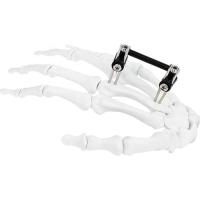 China Orthopedic Surgical Mini Fragment Ilizarov External Fixation Device for sale