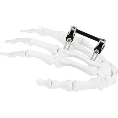 China Orthopedic Surgical Mini Fragment Ilizarov External Fixation Device for sale